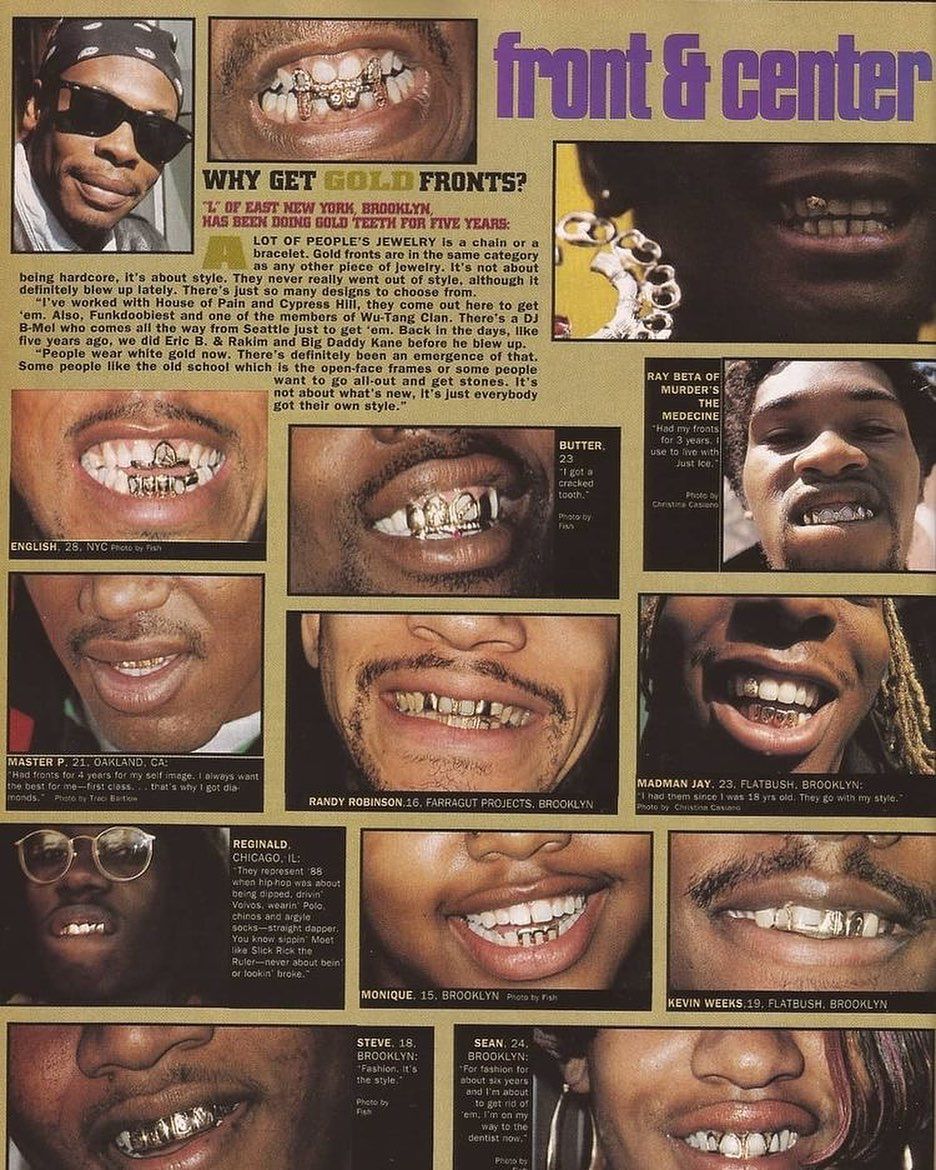 La obsesión por los grillz: un repaso completo a su historia y evolución