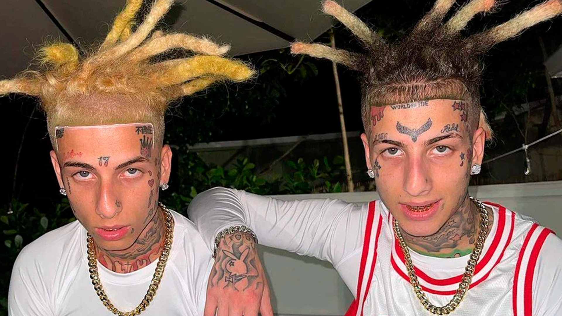 Kodiyakredd de los Island Boys sufre una convulsión